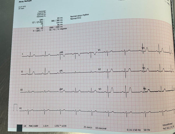 GE MAC 1600 Resting ECG System – MedProShop